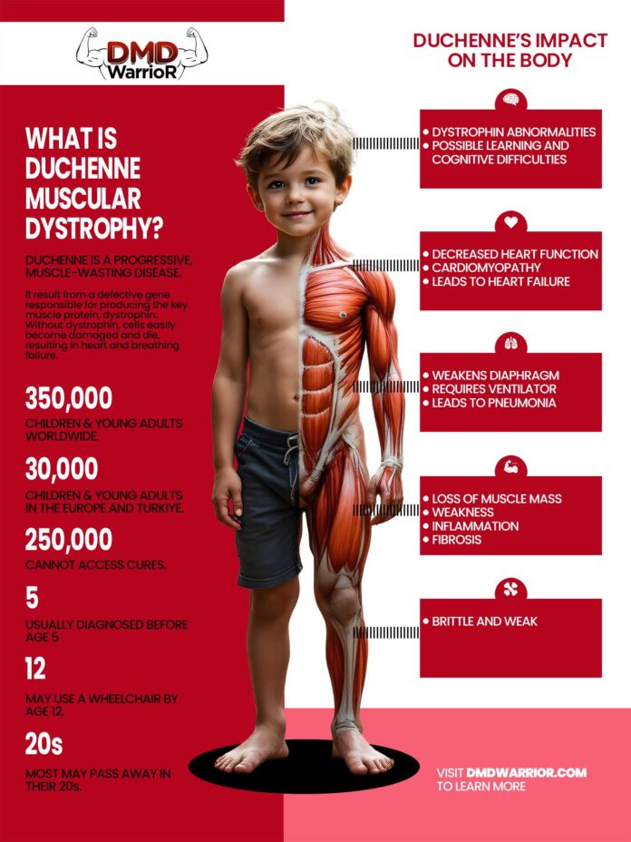 ¿Qué es la distrofia muscular de Duchenne? Síntomas, causas y esperanza ...