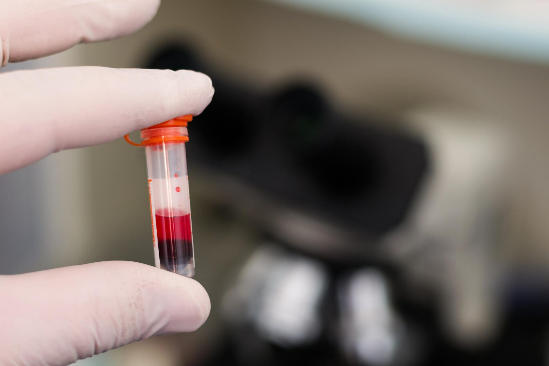 DMD Genetic Testing: 20 Things You Should Definitely Know - DMD Warrior